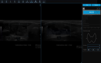 Koios Medical - Products, Competitors, Financials, Employees ...