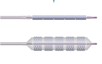 Efemoral Medical - Products, Competitors, Financials, Employees ...